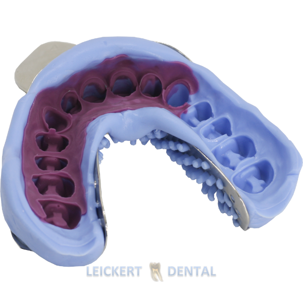 LEICKERT-DENTAL - PUTTY ABFORMMATERIAL